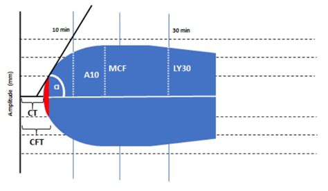 So You Ordered A Rotem On Your Icu Patient Now What Part 2 Of 2 Criticalcarenow