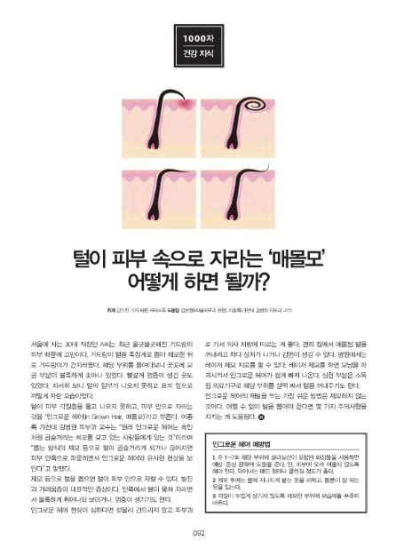 털이 피부 속으로 자라는 매몰모를 아세요 헬스조선 2016년 09월호
