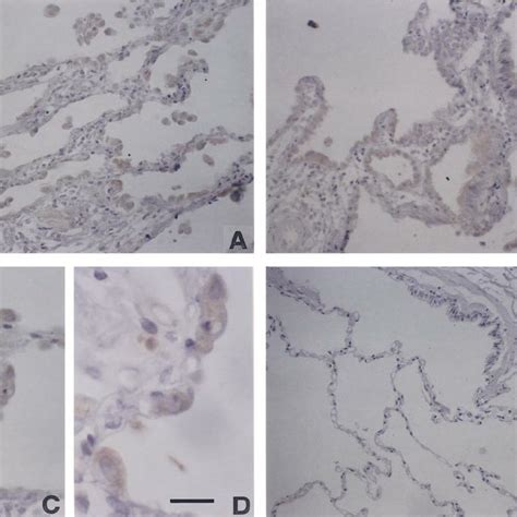 Immunohistochemical Analysis Of Fasl Cd15 Cd4 Cd8 And Paired Ihc