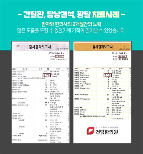 간기능이상의심 즉각적인 치료가 필요할수도
