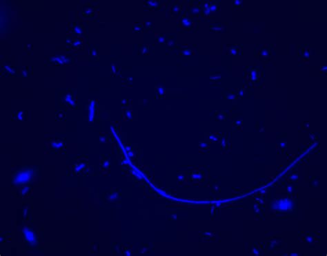 Sea Ice Diatoms Arctic Ocean Biodiversity
