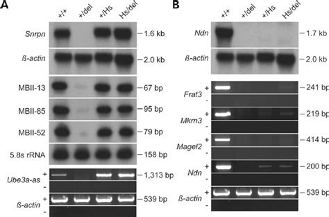 Analysis Of Gene Expression Following Paternal And Maternal Inheritance