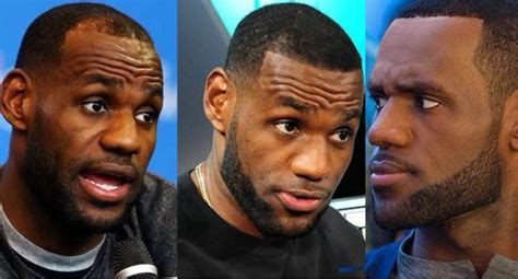 Lebron James Hair Transplant From Receding To Rebounding