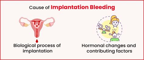 Implantation Bleeding Causes Symptoms And Treatment