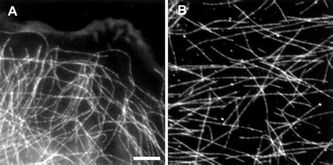 A Comparison Of The Random Speckle Pattern Of Fluorescence Along