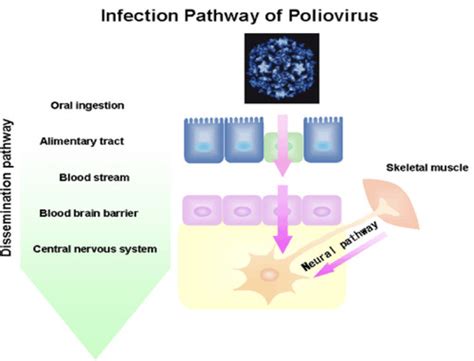 Poliopost Polio Syndrome Flashcards Quizlet