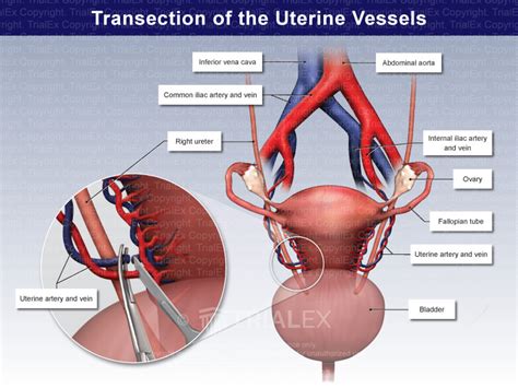 Uterine Artery Anatomy