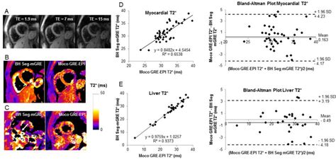A Motion Corrected Averaged T2 Weighted Images At Te 1 9 7 And 15 Download Scientific