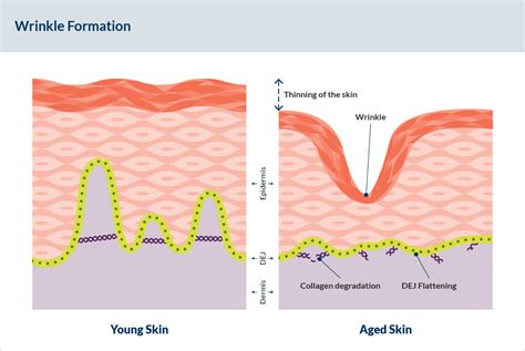 Wrinkle Reduction Juventide™