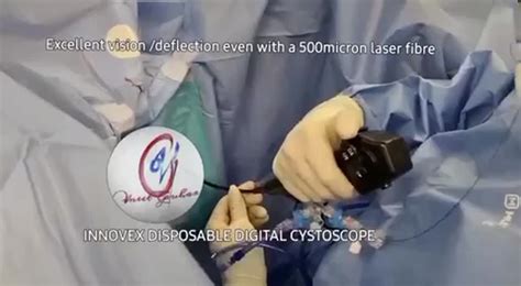 Innovex Medical On Linkedin Innovation Premiumquality Endourology