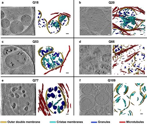 Cryo Em For Biological Tissues Structure Characterization Service Mtoz Biolabs