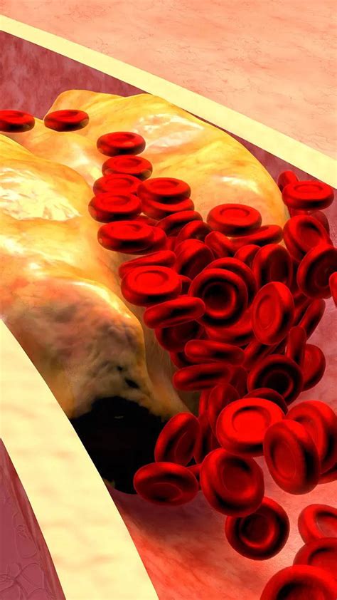 कोलेस्ट्रॉलची पातळी कमी करण्याचे प्रभावी मार्ग