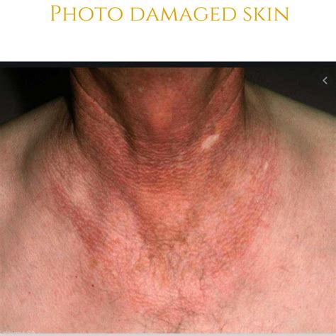 Your Décolleté Skin And How To Look After It Sensoria