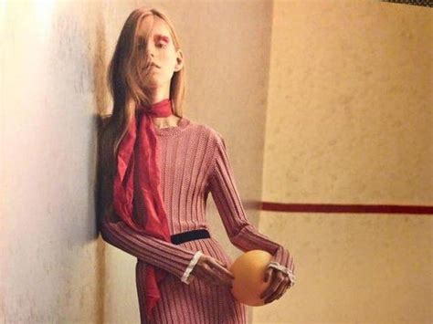 Fashion Magazine Apologizes For Anorexic Cover Model