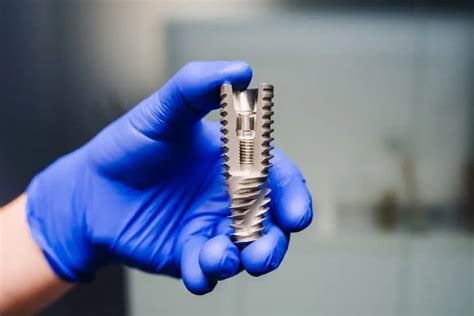 Abutment Screw Loosening In Dental Implants