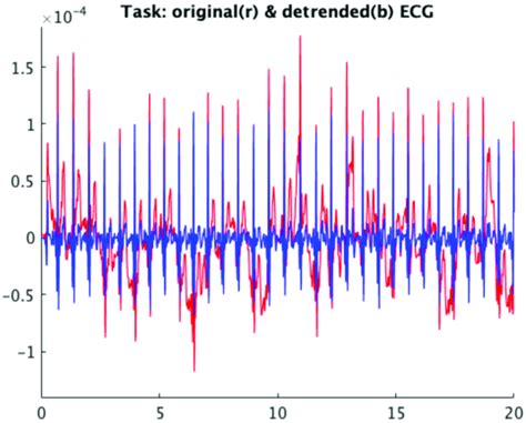 Original Ecg Signal Red And Signal Obtained After Preprocessing