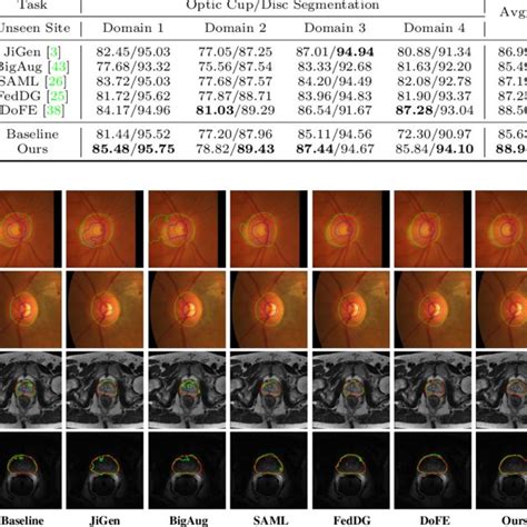 Dice Coefficient Of Different Methods On Fundus Segmentation Task