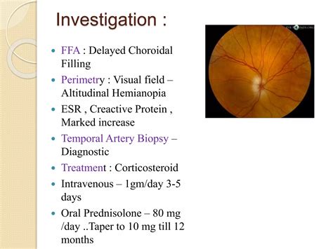 Optic Nerve Disease Pptx
