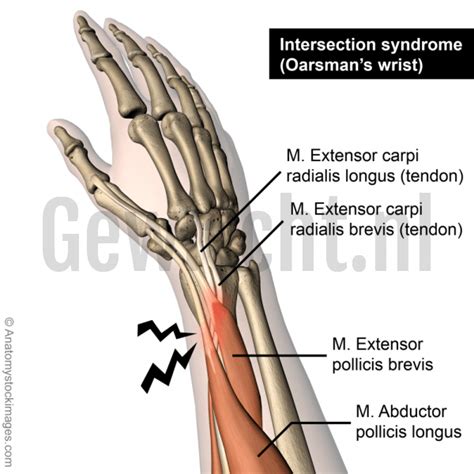 Hip Hamstring Hamstrings Semi Membranosis Biceps Femoris Semitendinosus