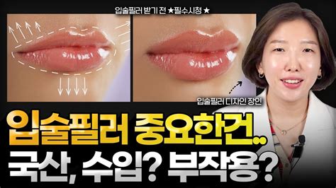 입술필러 국산 수입 어떤걸 맞아야 할까 필러 선택방법 부작용 유지기간 무조건 알고 받으세요 Youtube