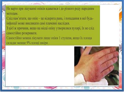 Невідкладна домедична допомога Види і наслідки кровотеч Невідкладна