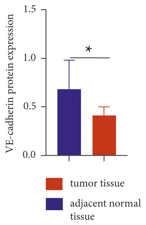 Sox17 Cyclin D1 And Ve Cadherin Protein And Mrna Expression Ac