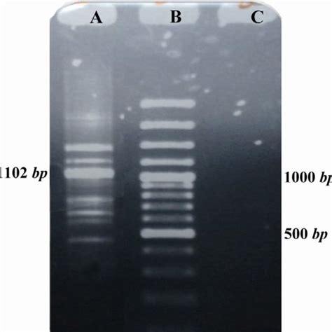 Amplification Of Apn Using Exon Junction Primers A 516 Bp Fragment
