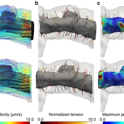 Fluid Structure Interaction Simulation Under Z− Z Flow Conditions A