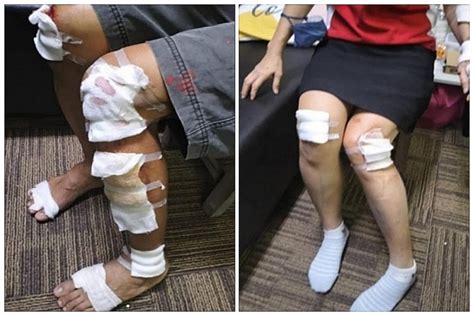 Suspek Samun Ragut Ditahan Tak Sampai 3 Jam Selepas Polis Terima