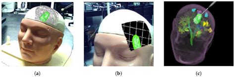 Augmented Reality In Surgical Navigation A Review Of Evaluation And