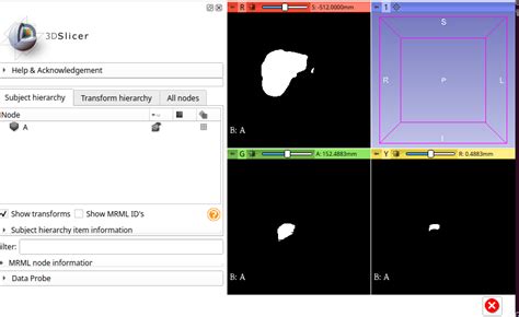 Slicer Loads Nii File Instead Of Nii Gz File If Filenames Are The Same