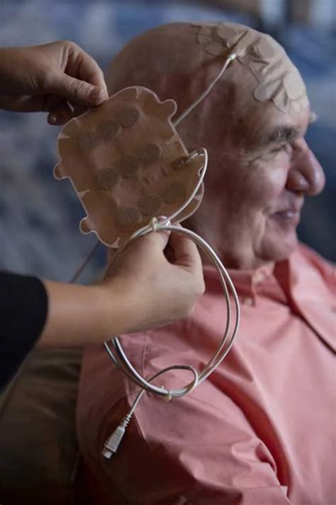Orbitozygomatic Craniotomy Oz Atlantic Brain And Spine