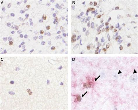 Nfia Expression Is Restricted To Astrocyte Lineage Cells In Normal Download Scientific Diagram