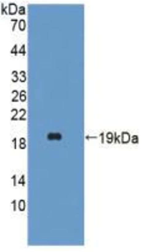 Hemoglobin Alpha 1 Polyclonal Antibody Invitrogen 20 μl Unconjugated