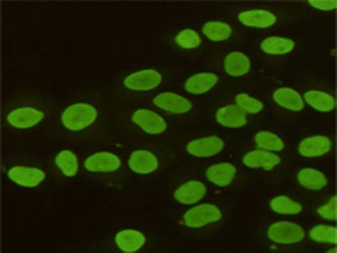 小鼠抗trim28单克隆抗体anti Trim28 Mouse Monoclonal Antibody 生命科学产品与技术服务 生工生物工程