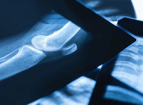 Jak często można robić rezonans magnetyczny Centrum Medyczne MRI LAB