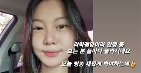 데이트 선택 번복나솔 16기 영자 충혈된 눈→안타까운 근황 각막궤양