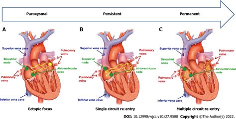 Human Induced Pluripotent Stem Cell Atrial Specific Cardiomyocytes And