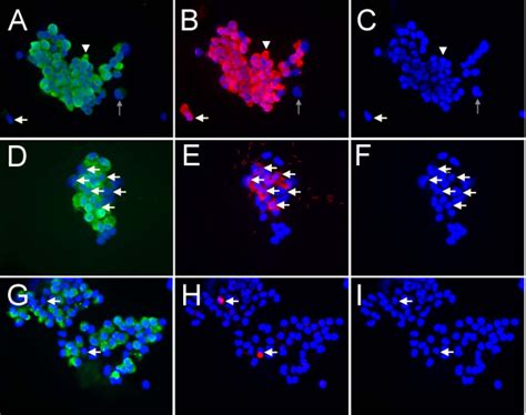 Representative Cytospin Preparation Of Isolated Cells A D G Cc10