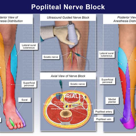 Popliteal Block