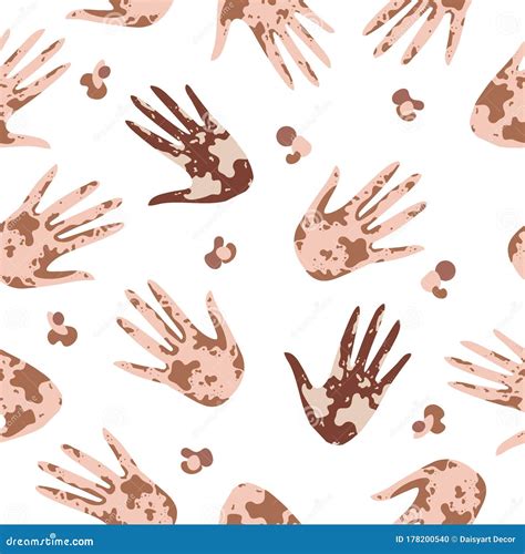 Vitiligo Pattern Cartoon Vector 202250037