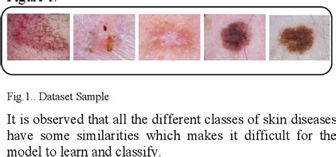 Figure 1 From Multiclass Skin Disease Classification Using Generative Adversarial Networks And
