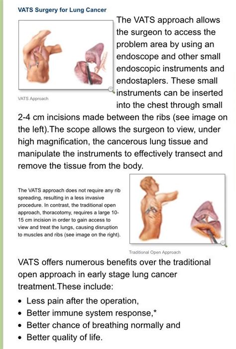 Pin On Endometriosis