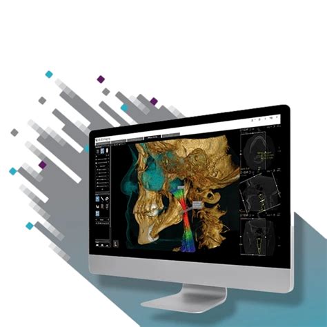 Cs 3d Imaging Cs Airway Carestream Dental