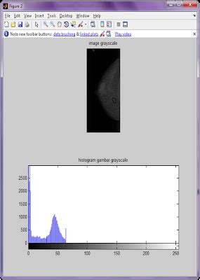 UserSpace Blog For Sharing Implementasi Fungsi Histogram Equalization Pada MATLAB