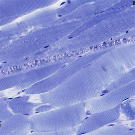 An Image Of Skeletal Muscle At 40x Magnification On Pathcore Flow Download Scientific Diagram