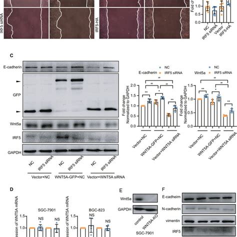 IRF5 Regulated E Cadherin Expression Via Wnt5a A B The Representative