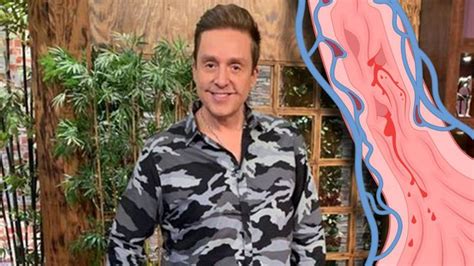 Daniel Bisogno Fue Hospitalizado ¿qué Son Las Várices En El Esófago