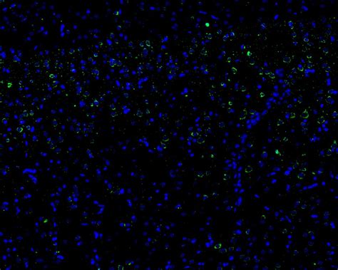 Calretinin Recombinant Rabbit Monoclonal Antibody Jm12 93 Et1705 19