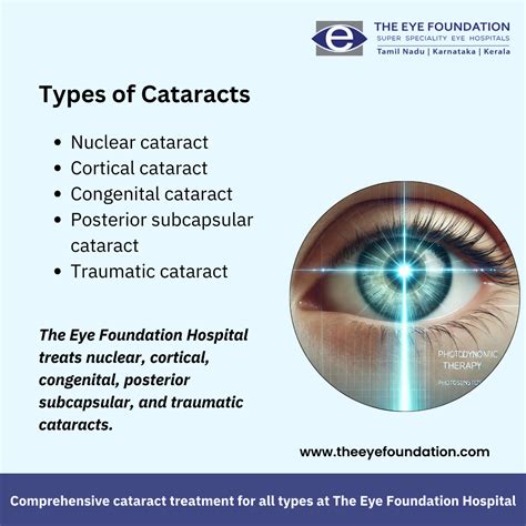 Are There Different Types Of Cataracts